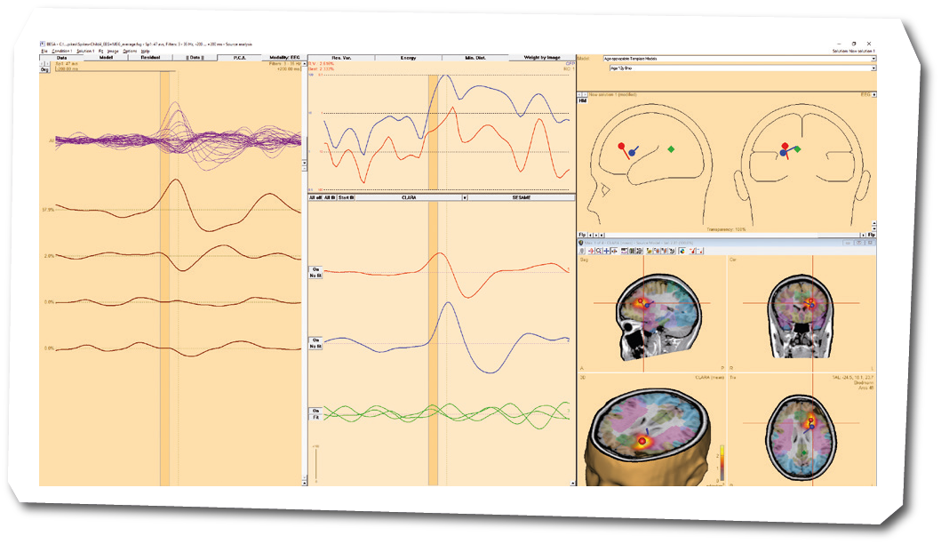 BESA Research Software | Brainbox